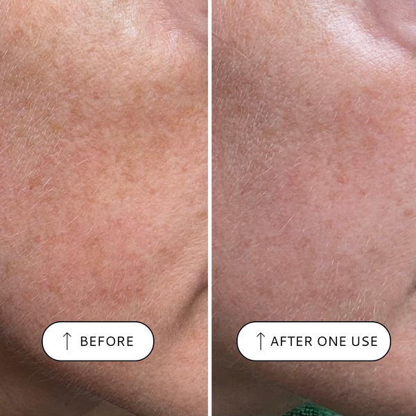 Sensitive Resurfacing Peel | Votary Luxury Plant-Based Skincare - VOTARY